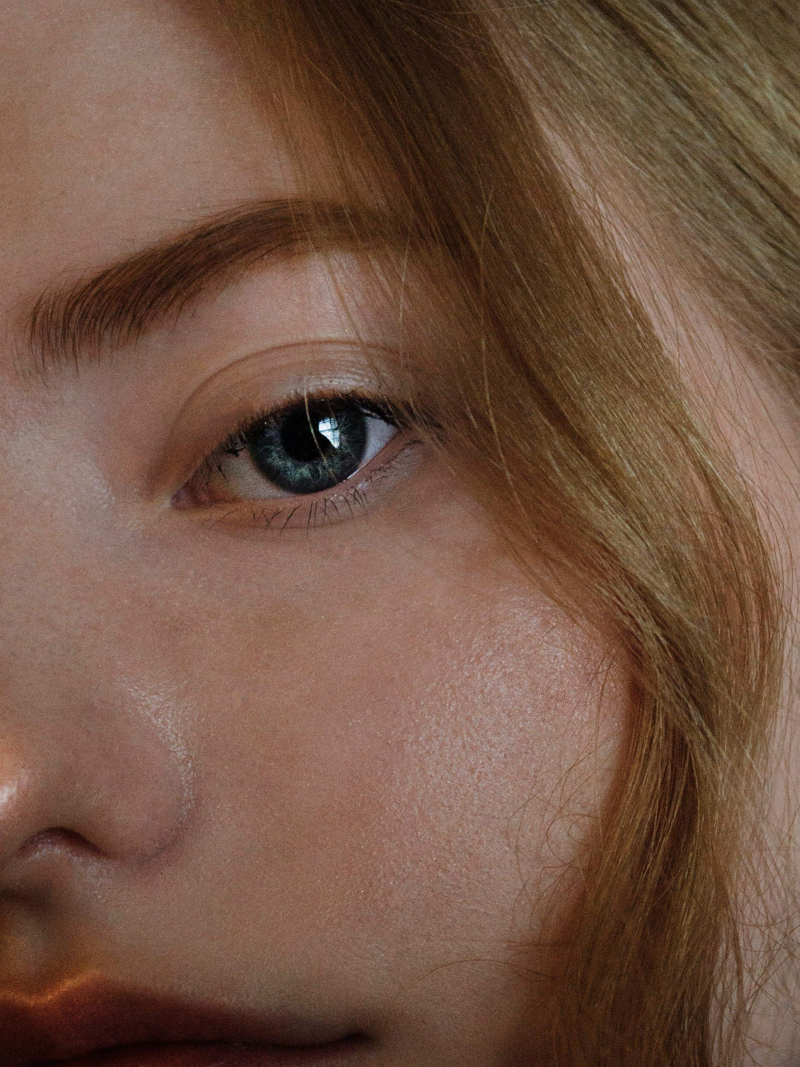 Signs of high cholesterol that are visible in eyes