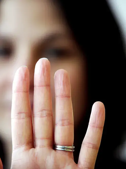 Why do fingers wrinkle in water?