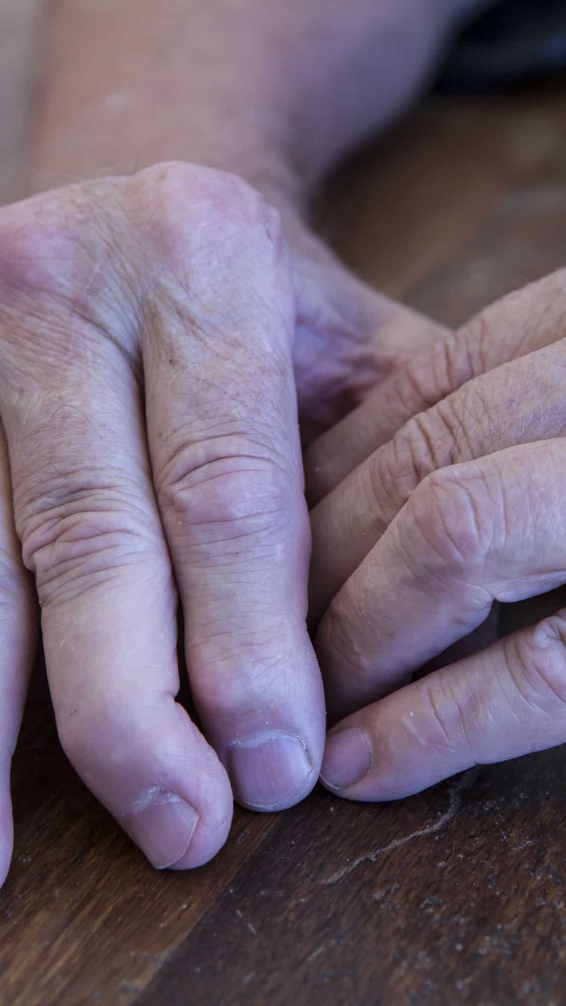 7 Foods to avoid if you have arthritis