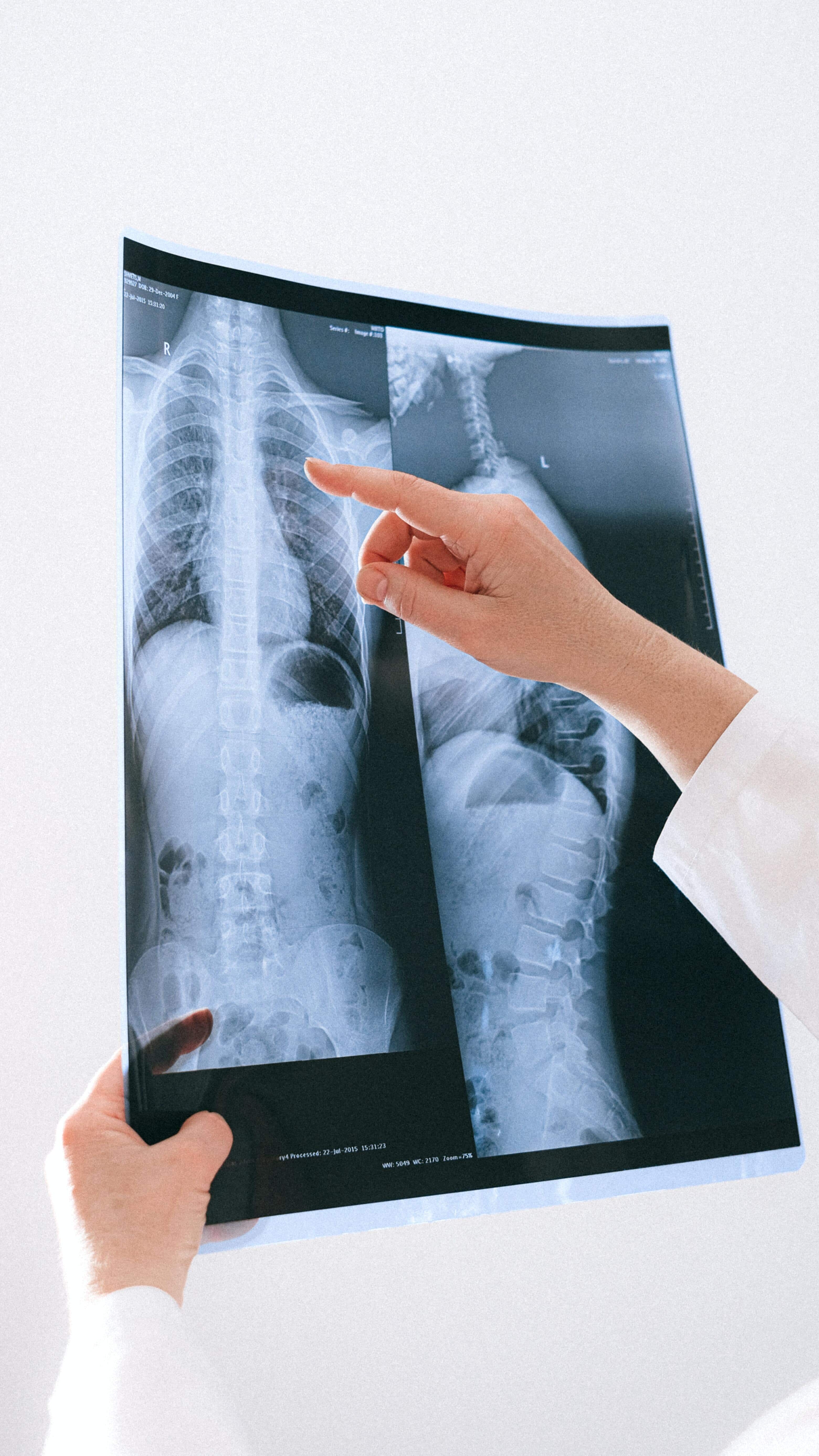 Lung disease: 7 superfoods to fight COPD