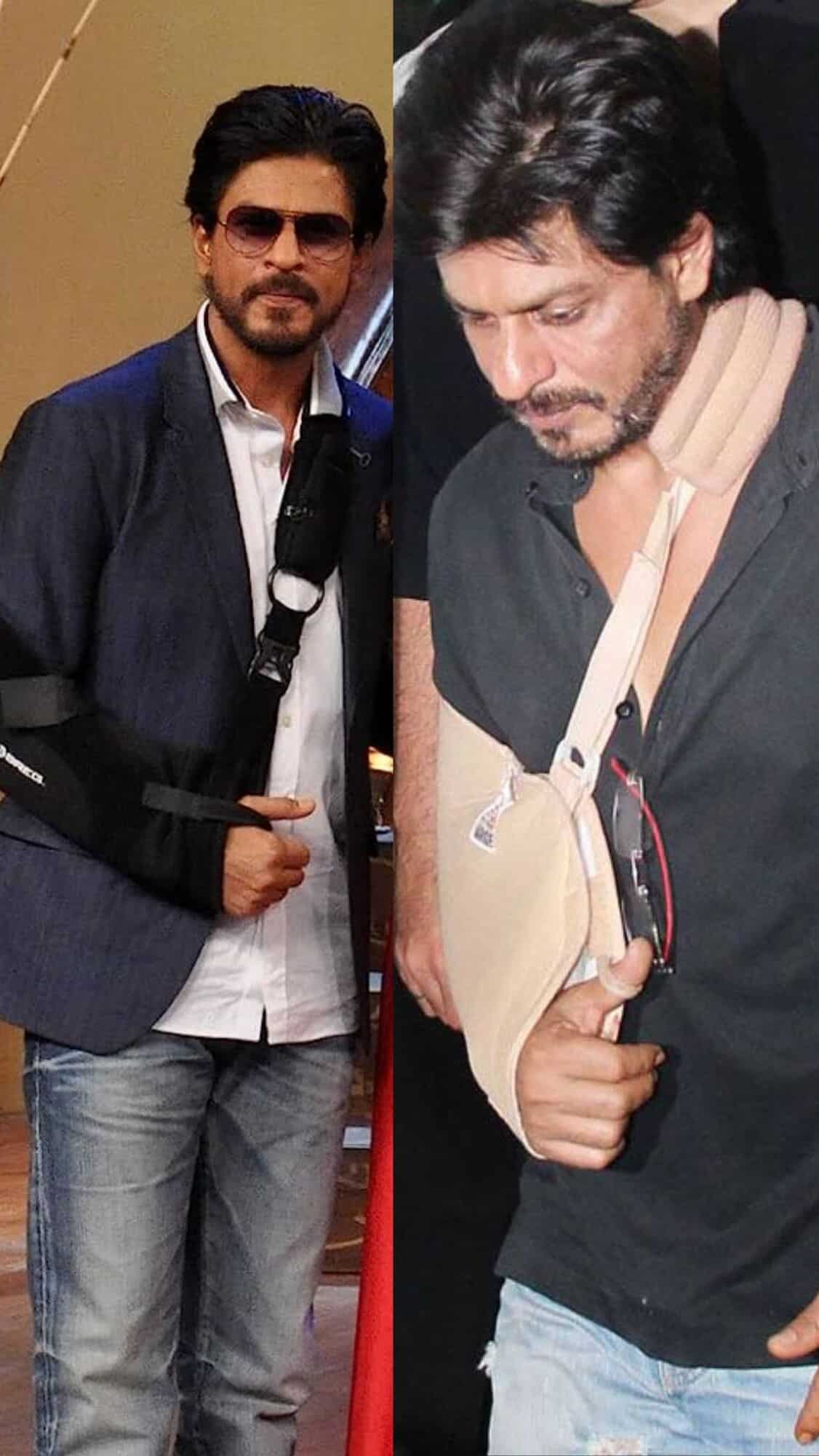 Injuries faced by Shah Rukh Khan during film shoots