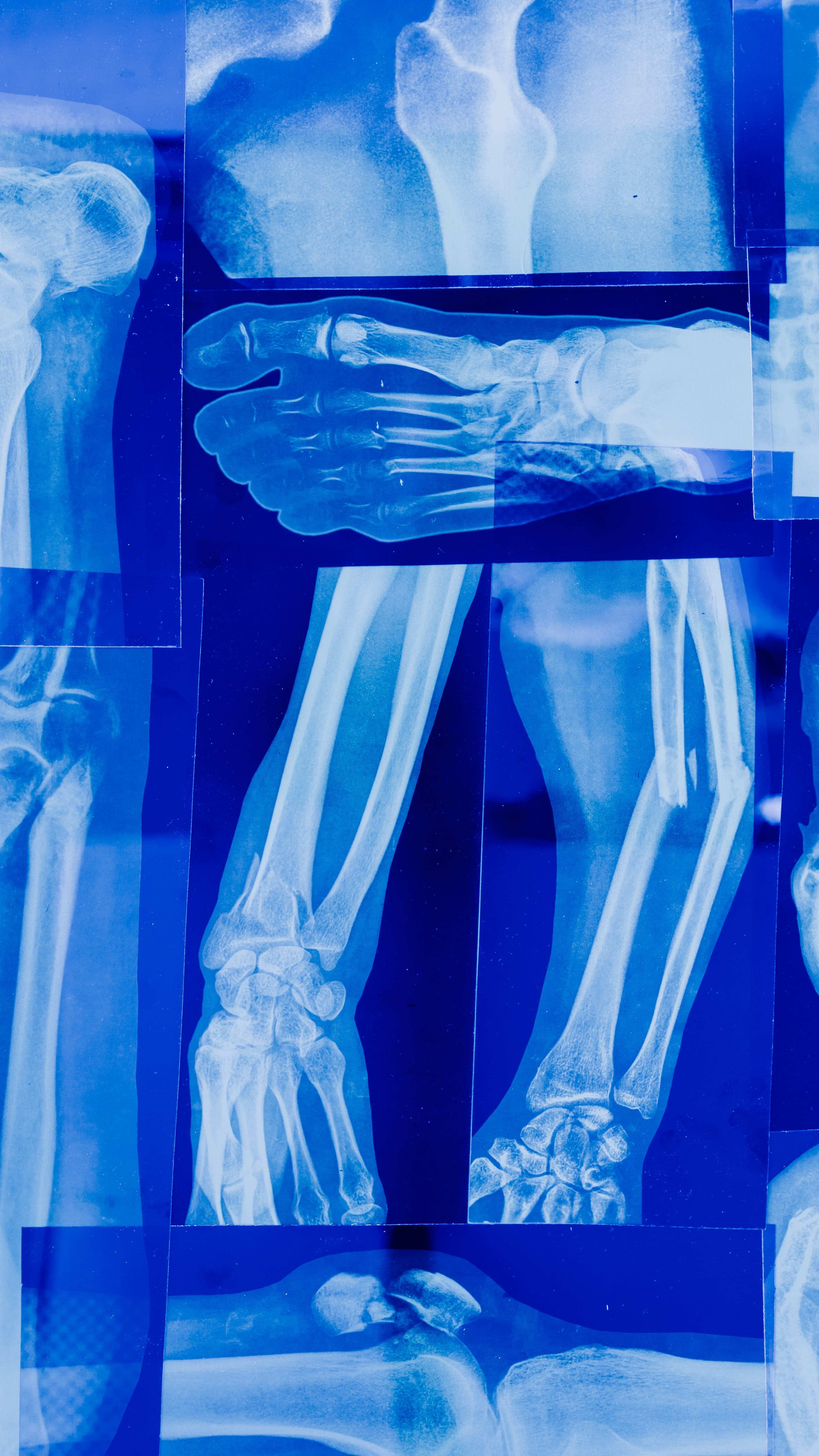 8 vegetarian foods for strong bones