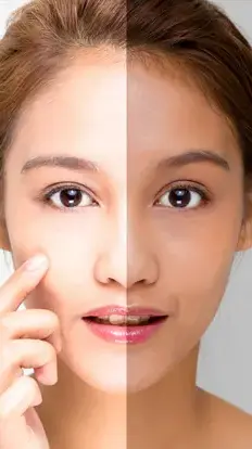 7 easy home remedies to remove neck tan this summer